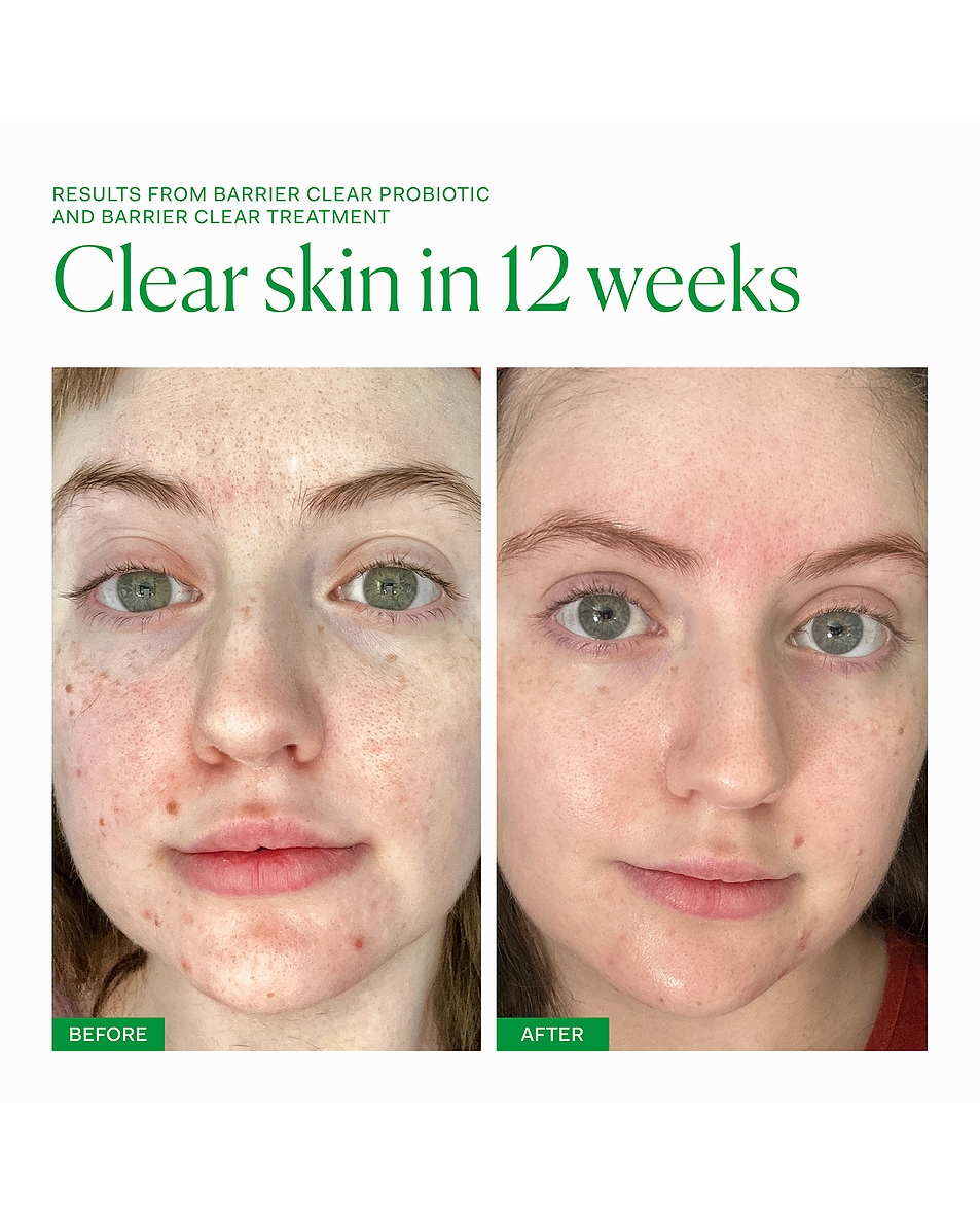 The Nue Co. Barrier Clear Treatment | FWRD